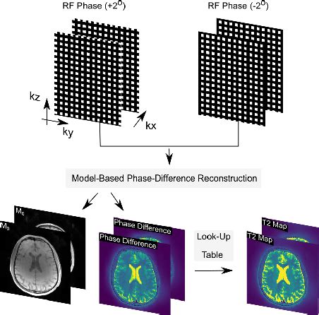 Figure 1 From Model Based Phase Difference Reconstruction For