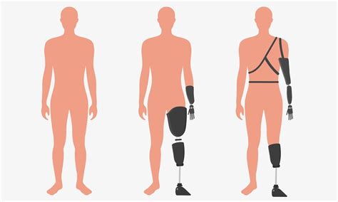 Premium Vector People Prosthesis Amputation Inclusion