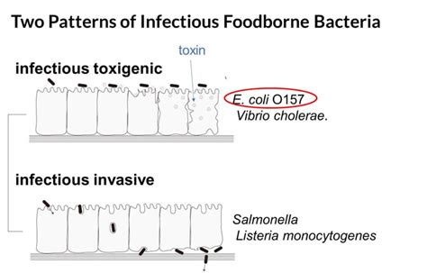 Uncovering Shiga Toxin Producing Escherichia Coli Stec Infection