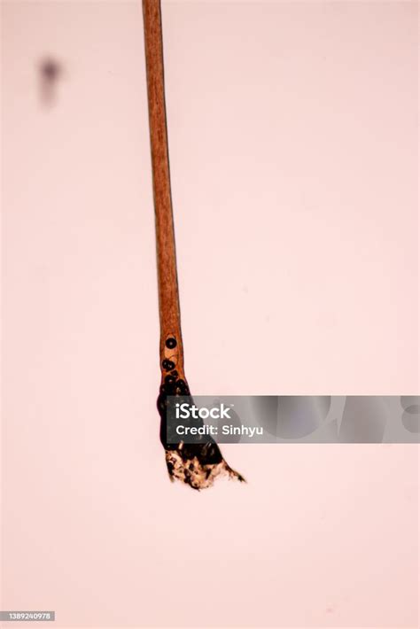 실험실에서 교육에 대 한 현미경 보기에서 인간의 머리 세포의 특성 모낭에 대한 스톡 사진 및 기타 이미지 모낭 배율 뿌리 Istock