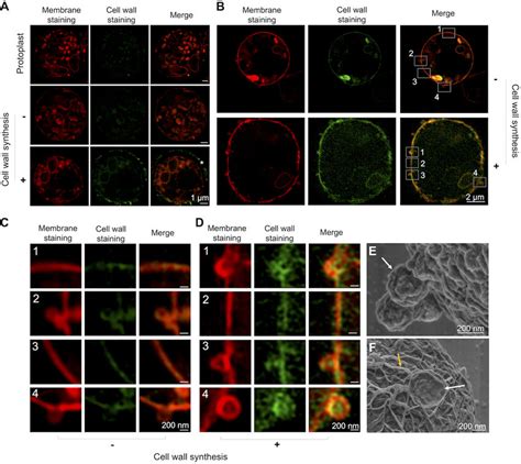 Membrane Projections In A Fumigatus Protoplasts A Freshly Purified