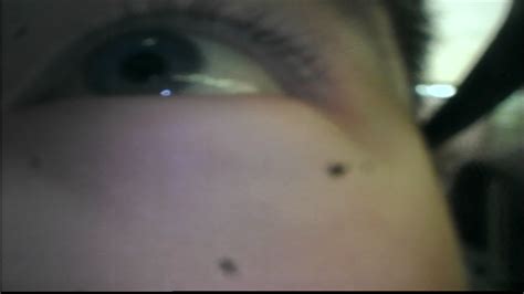 Pupil Extendtion Object Detection Dataset By Eyetracker