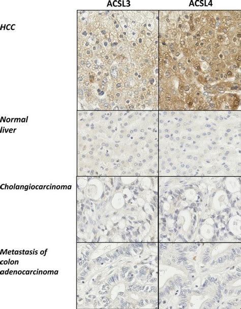 Acsl3 Polyclonal Antibody Pa5 42883