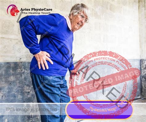 Hip Osteoarthritis Aries Physiocare