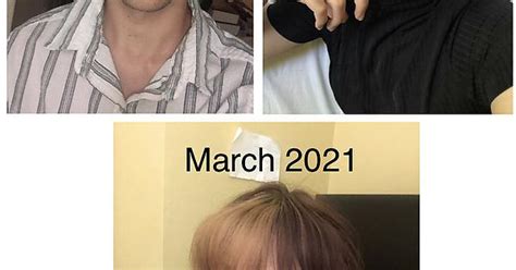 20 Mtf ~1 Year On Hrt Imgur