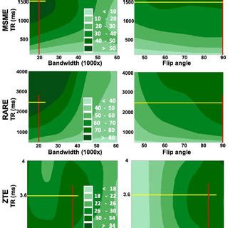 Optimization Of Sequence Parameters Download Scientific Diagram