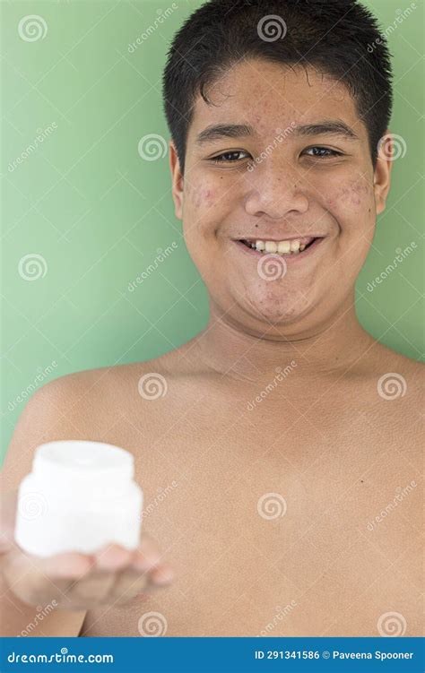 Portrait Of Young Man With White Cream Problematic Skin And