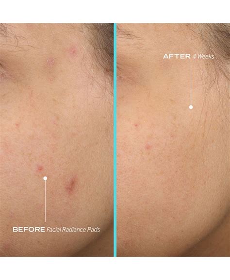 First Aid Beauty Facial Radiance Pads 60 Ct Macys