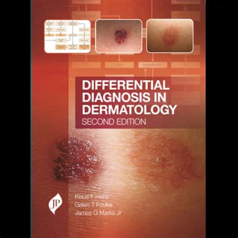 Fundamentals Of Hair And Scalp Dermoscopy By Doche Isabella Mybooksfactory