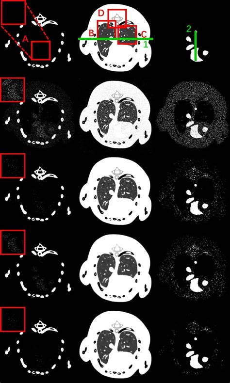 Material Decomposition Results Of The Numerical Mouse The 1 St 3 Rd