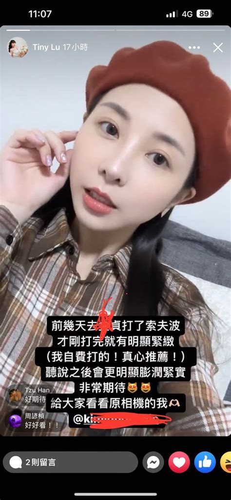 詢問 詢問 直男如我也想跟著名人做醫美 醫美板 Dcard