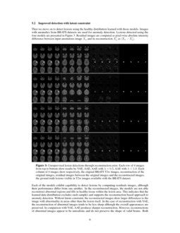 Unsupervised Detection Of Lesions In Brain MRI Using Constrained Adversarial Auto Encoders DeepAI