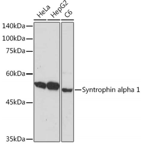 Syntrophin Alpha 1 Recombinant Rabbit Monoclonal Antibody 3b10g10
