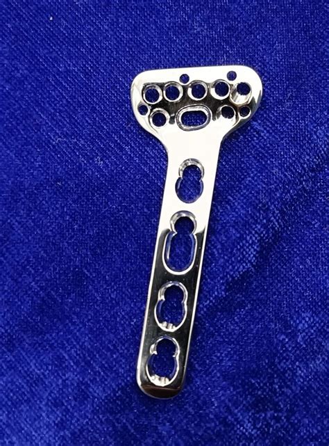 Titanium 2 7mm Distal Radius Kopis Locking Plate At Rs 800 In Gondal