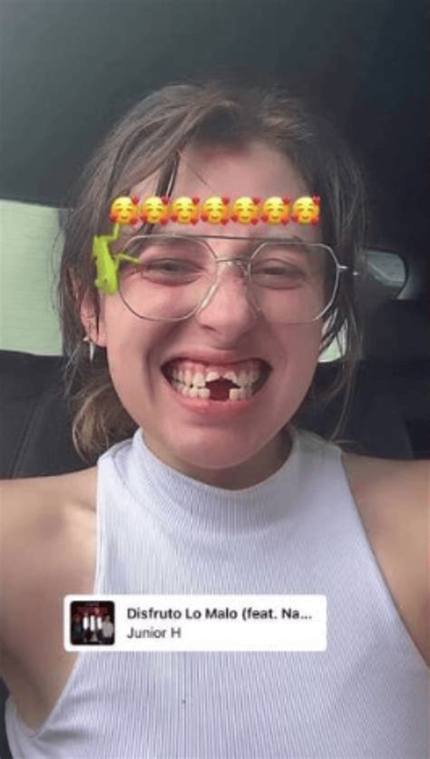 Hija De Angélica Rivera Vive Estrepitoso Accidente Queda Sin Dientes