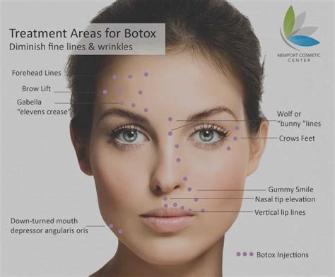 Visual Guide To Botox Injections For Facial Rejuvenation