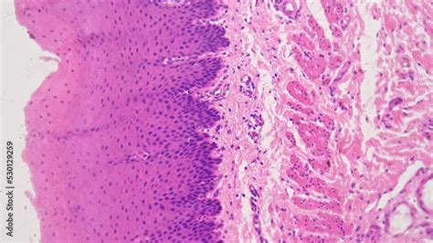 Stratified Squamous Epithelium Filmed By Microscope With 200x Against Bright Field Macro