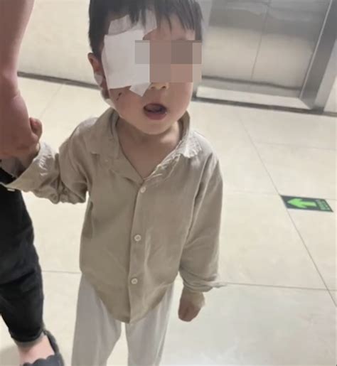 河南3岁男童被狗咬伤18天后身亡，咬人的狗去向不明，警方已提级调查腾讯新闻