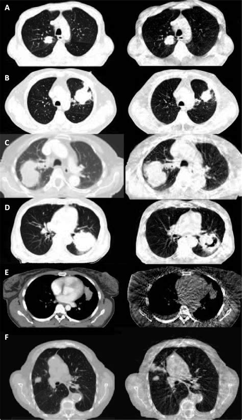 Cone Beam Ct Image Quality The Best Picture Of Beam
