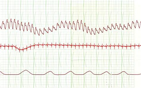 Polygraph Chart 2 The Philadelphia Experiment From A Z