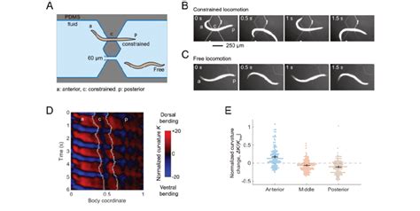 3 Microfluidic Constraint Of Midbody Causes Increase In Anterior Download Scientific Diagram