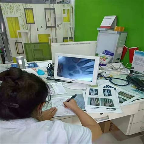 手持式骨龄检测仪 儿童生物学年龄确定仪 可透视骨骺线x光机j50型