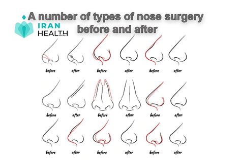 Perfect Female Nose Shape