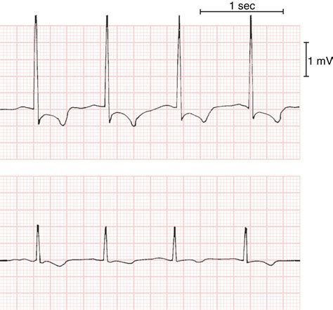 Cardiovascular Monitoring Clinical Tree