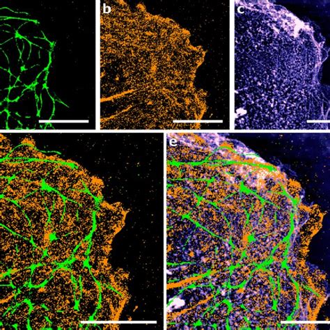 Two Color Correlative Smlm Afm Imaging Of Microtubules And Actin A