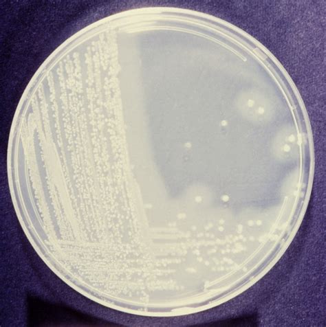 Public Domain Picture This Gelatin Agar Medium Was Used In The