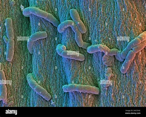 Bacillus Cerus Bacteria Coloured Scanning Electron Micrograph Sem Of Small Chains Of Bacillus
