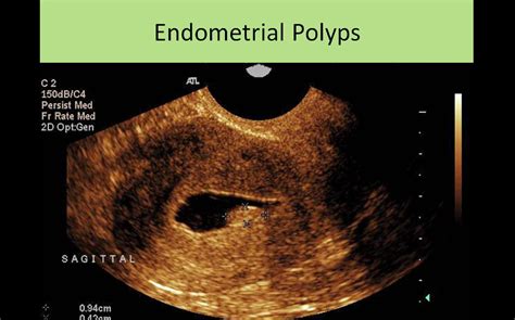 Ultrasound Registry Review Products