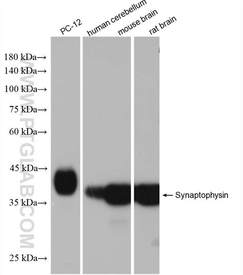 Results For Synaptophysin Proteintech Group 武汉三鹰生物技术有限公司