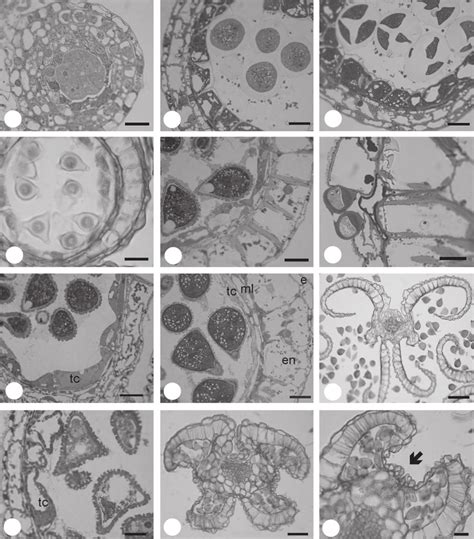 Light Micrographs Of Microsporangium Tissues In Different Stages Of Download Scientific Diagram