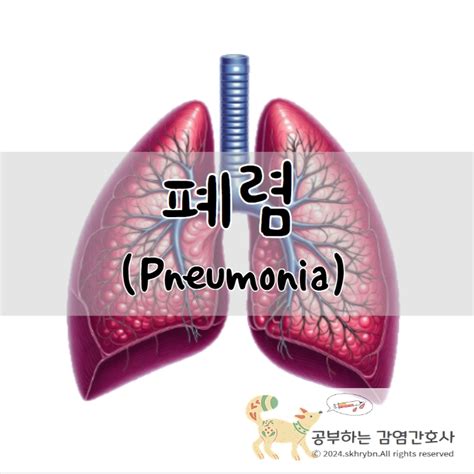 아동 간호폐렴pneumonia의 원인 증상 치료 간호 진단