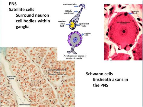 Bipolar Neuron Slide