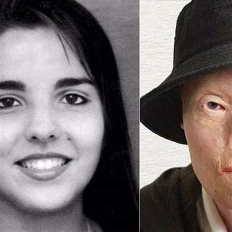 La Trágica Historia De La Mujer Que Se Convirtió En El Rostro De
