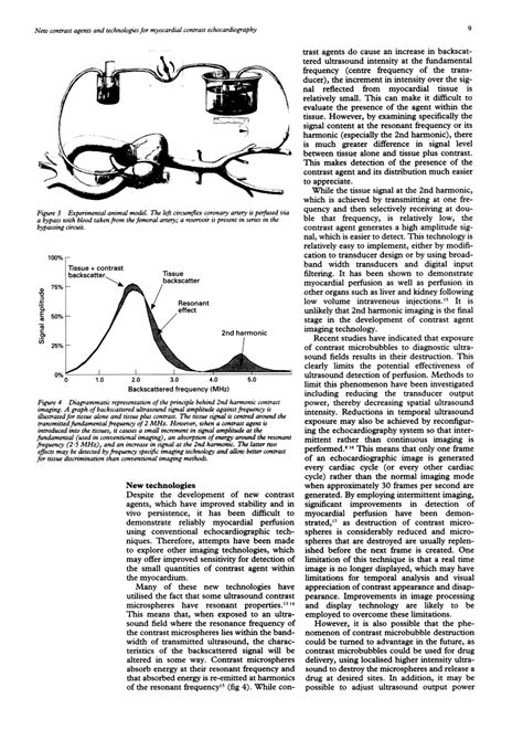New Contrast Agents And Technologies For Myocardial Contrast Echocardiography Abstract