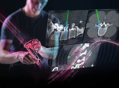 Spinal Navigation Digitalizing Spine Surgery Brainlab