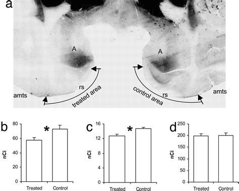 Rhinal Cortex Sectioned View