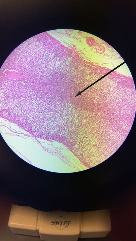 Adrenal Gland Histology Diagram Quizlet