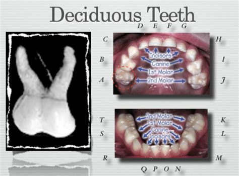 Deciduous Teeth Flashcards Quizlet