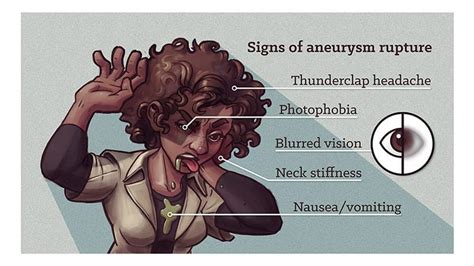 An Introduction To Brain Aneurysms Brainbook