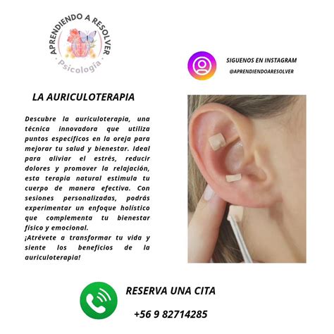 Aprendiendo ¡nuevo En Nuestro Centro Descubre La Auriculoterapia 🌿