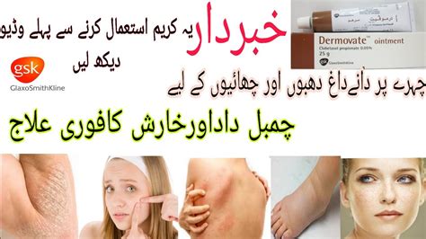 How To Use Dermovate Ointment Dermovate Ceam Dermovate Nn Ointment