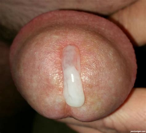 Lusttropfen Kostenlose Penis Bilder Und Schwanzfotos