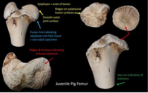Using Osteoid Osteoid Bone Identification