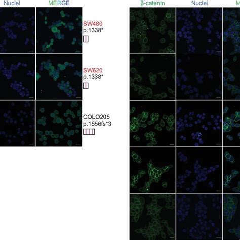 Evaluation Of β Catenin Localization In Crc Cell Lines With And Without Download Scientific