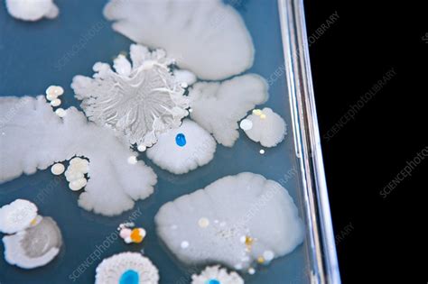 Bacterial Hydrophobicity Test Stock Image C0361213 Science Photo
