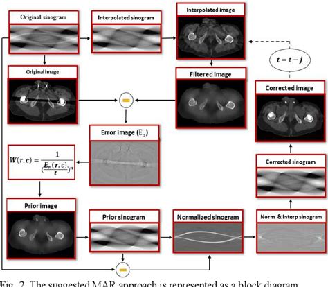 Figure 1 From A Novel Iterative Prior Fusion Based Metal Artifact